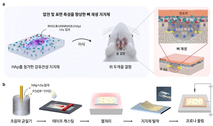 KAIST “금 간 뼈 재생... ‘뼈 반창고’압전 신소재 개발”